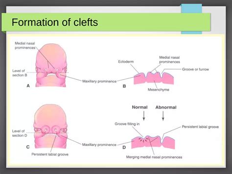 Cleft Lip And Palate Pdf