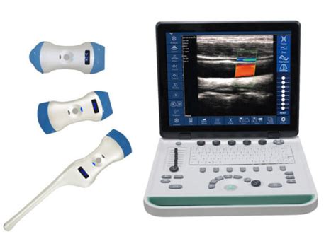 Uprobe Portable Wireless Ultrasound Diagnostic System With Wireless