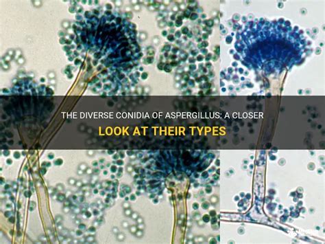The Diverse Conidia Of Aspergillus A Closer Look At Their Types Medshun