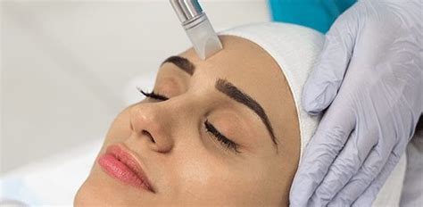 Digital Skin Micro Needling Cardiff Contour Laser And Aesthetics