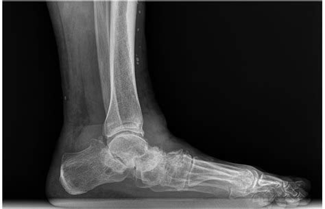 Lets Get This Party Started