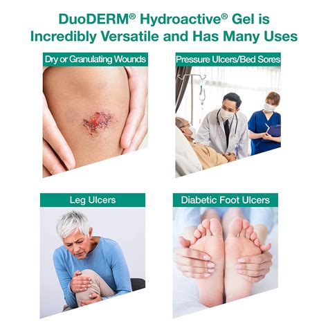Duoderm Hydroactive Sterile Gel 30 Grams Tube For