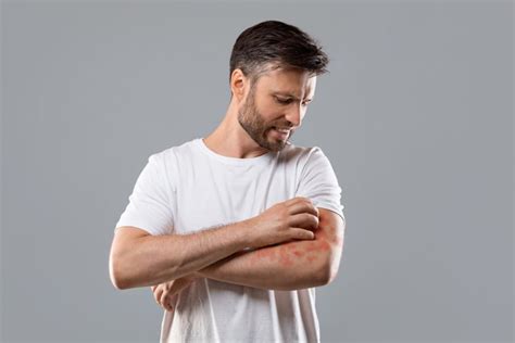 Dermatite erpetiforme cos è perché si manifesta e quali sono i sintomi