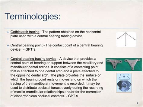 Gothic Arch Tracing Pptx