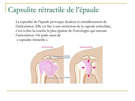 PPT L épaule PowerPoint Presentation free download ID 6414603