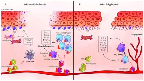 Polyphenols Enhance Diabetic Wound Healing A Impaired Wound Healing