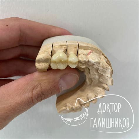 Зачем нужна вкладка под коронку? | Галишников Олег | Дзен