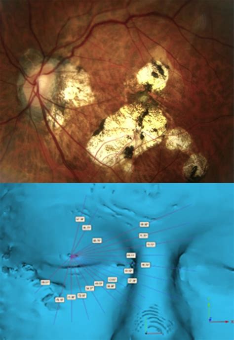 Ophthalmology Grand Rounds 2022 Online Cme Course Mayo Clinic School