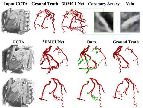 Xu Yan Chinese University Of Hongkong Shenzhen