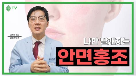 안면홍조 원인을 알고 한의원에서 제대로 치료하기 Youtube