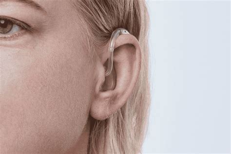 Oticon Xceed Bte Ultra Power Rishi Speech And Hearing Solutions