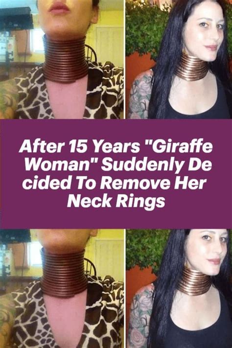 After 15 Years Giraffe Woman Suddenly Decided To Remove Her Neck Rings
