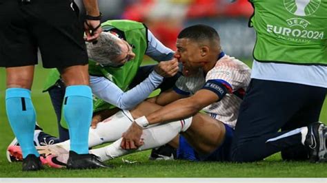 Kylian Mbappé Nez Cassé Ne Devrait Finalement Pas être Opéré