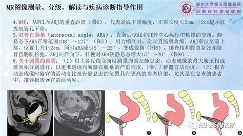 Ppt Mri Ppt