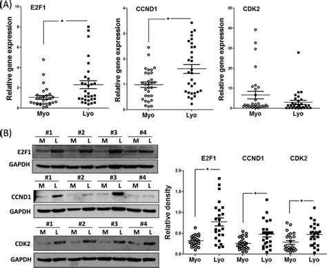 Regulation Of Cell Cycle Regulatory Proteins By Micrornas In Uterine Leiomyoma Pmc