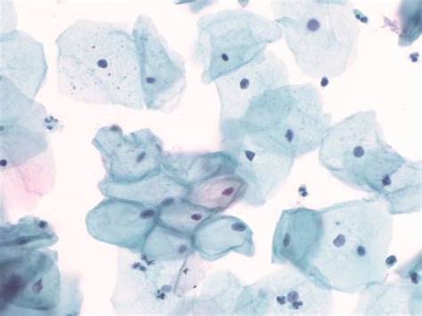 1 2 Cytomorphology Basic Concepts Mgh Learn Pathology
