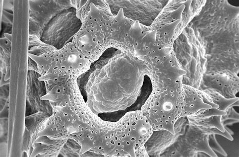 Pollen On A Bee Seen Through A Powerful Microscope Others