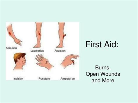 Puncture Wound First Aid