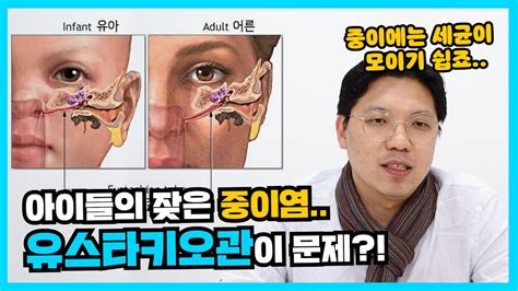 중이👂에 자주 생겨서 중이염 어른보다 아이👶가 취약한 해부학적인 이유는 해부해부러 Youtube