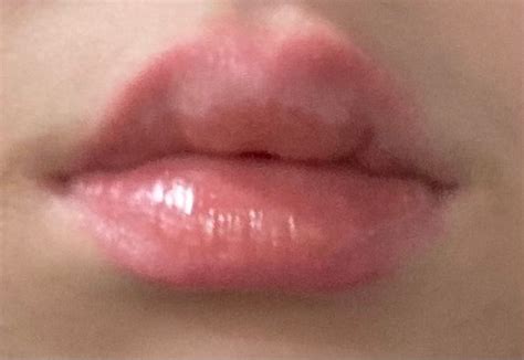 입술 부음 지식in