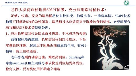 急性颅内大血管血运重建踹马桶技术应用 脑医汇