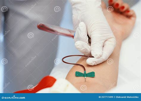 Arterial Blood Sampling Stock Image Image Of Medicine 257717499