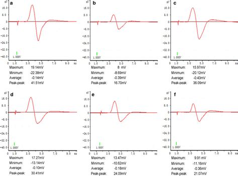 Representative Traces Of Compound Action Potential Cap Of