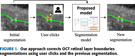 Figure 1 From Interactive Deep Learning Based Retinal Oct Layer Segmentation Refinement By