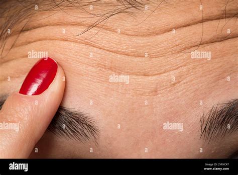 Close Up Of Womans Forehead Showing Wrinkles And Aging Skin Touching