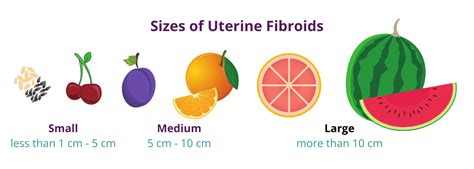 Uterine Fibroid Size Chart In Cm Uterine Fibroids Symptoms