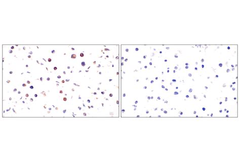 Tenascin C E6n4l Rabbit Mab Bsa And Azide Free Cell Signaling