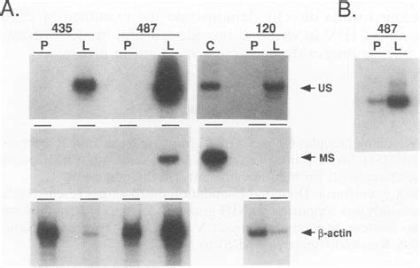 Hiv Rna Labcorp Test Code At Mark Morris Blog