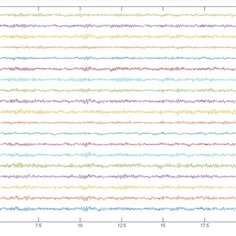 A Sample Frame Of The Eeg Signals Of A Person With Sz Eeg