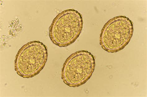 Huevo De Ascaris Lumbricoides Foto De Stock Y Más Banco De Imágenes De