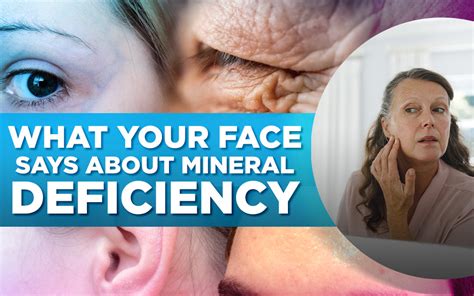 What Your Face Says About Mineral Deficiency Dr Livingood