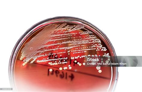 Grampositive To Gramvariable Nonmotile Coccus Beta Hemolysis Saprotrophic Bacterium That Belongs