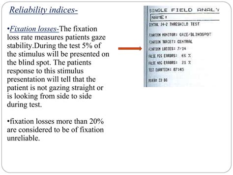 Automated Perimetry Ppt
