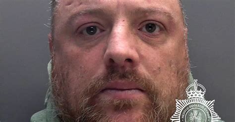 Broken Eye Socket Bone Had To Be Popped Back In After Man Punched