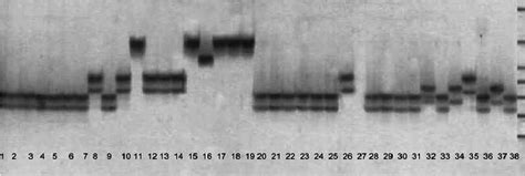 Polymorphic Pattern Of An SSR Marker RM270 Refer To The Table 1 For