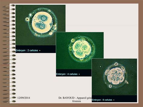 Ppt Appareil Genital Feminin Powerpoint Presentation Free Download