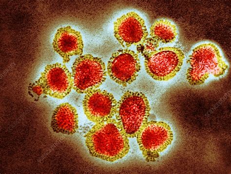 H3n2 Influenza Virus Particles Tem Stock Image F0209650 Science