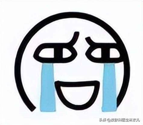 对胶布过敏有什方法解决 对胶布过敏怎么治疗 寻医问药 华网