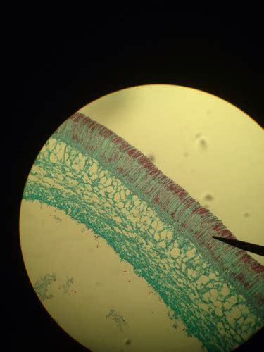 Slides Flashcards Quizlet