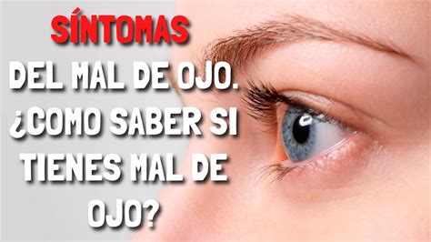 Síntomas del MAL del OJO Como saber si tienes mal de OJO YouTube