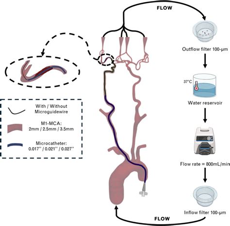 The Impact Of Microcatheter To Vessel Size Ratio On Distal Embolization