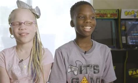 Embracing Uniqueness Twin Siblings Defying Stereotypes And Celebrating