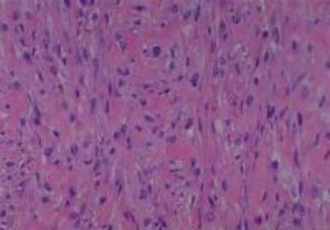 Novus Biologicals Human Multi Tissue Tissue Microarray Cancer Human
