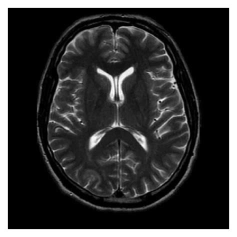 A The Reference Image B And C The Psnr And Hfen Value Versus