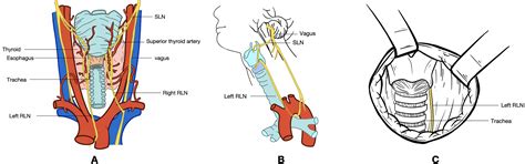 Recurrent Laryngeal Nerve