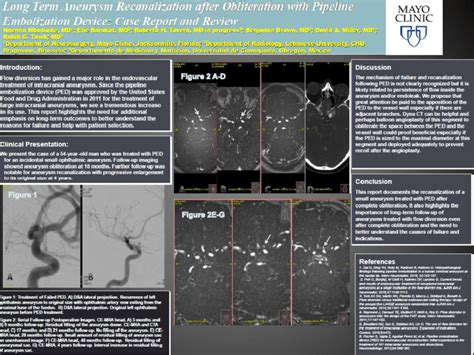 Pdf Long Term Aneurysm Recanalization After Obliteration With Pipeline Embolization Device